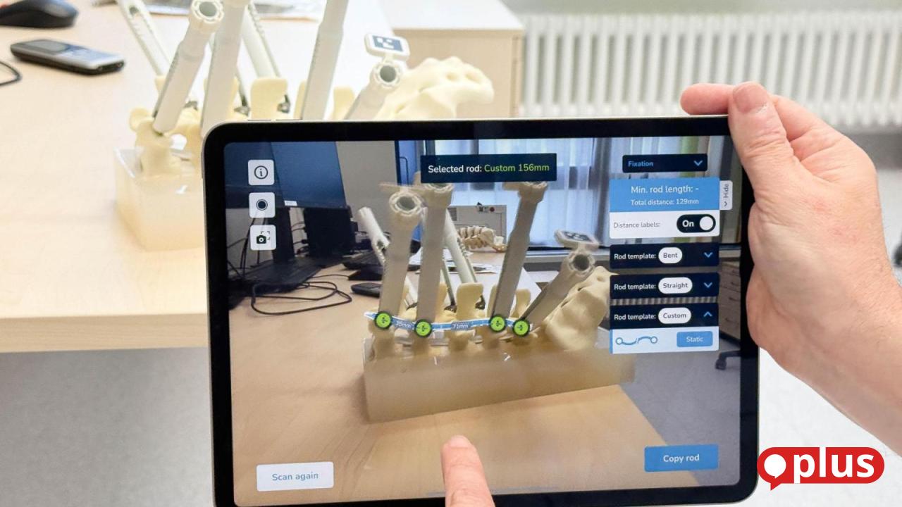 Augmented Reality hilft Patienten und Chirurgen am Klinikum Weiden | Onetz