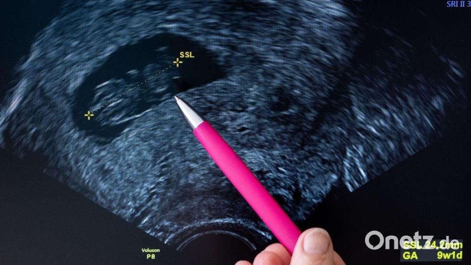 Schwangerschaftsabbruch: Wird Paragraf 218 noch reformiert? | Onetz